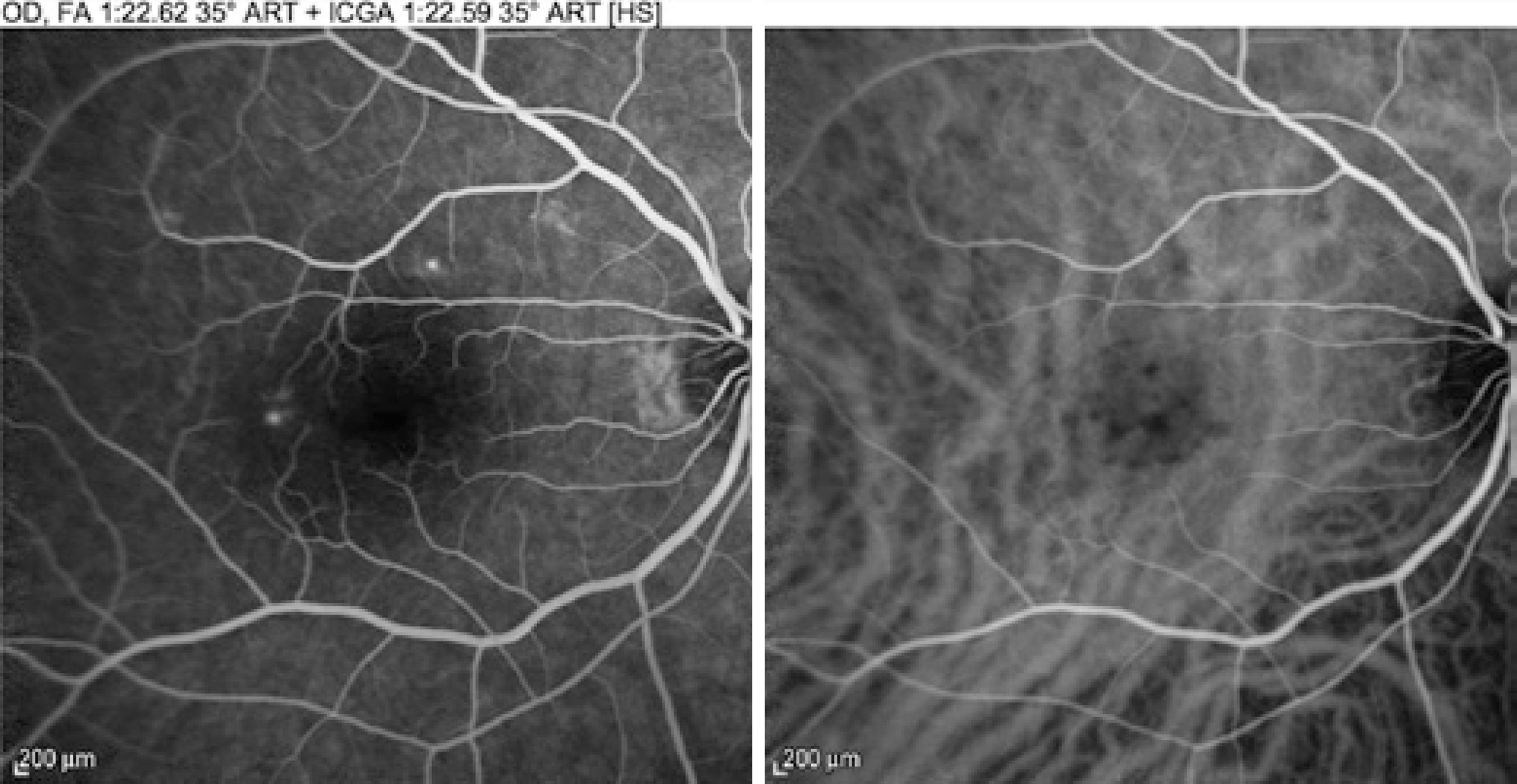 Arquivos Brasileiros de Oftalmologia - Multimodal assessment of ...